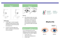 Eye Care - HSE.ie