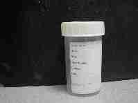 Microbiology index of specimen containers - HSE.ie